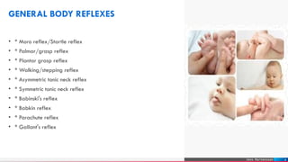 Newborn Reflexes PPT.pptx,,,,,,,,,,,,,,, | PPTX