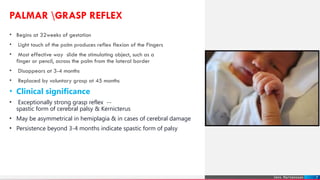 Newborn Reflexes PPT.pptx,,,,,,,,,,,,,,, | PPTX