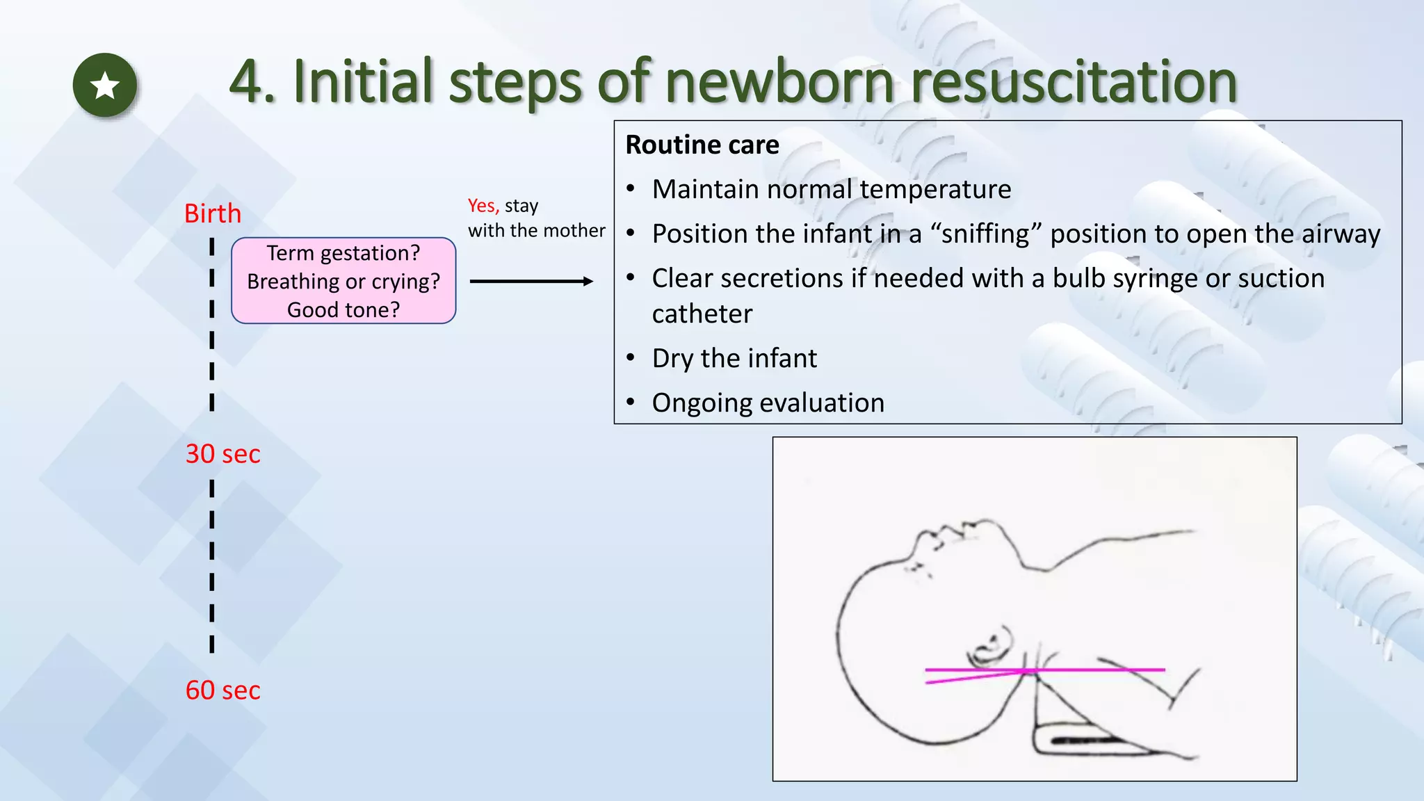 Newborn Resuscitation | PPTX