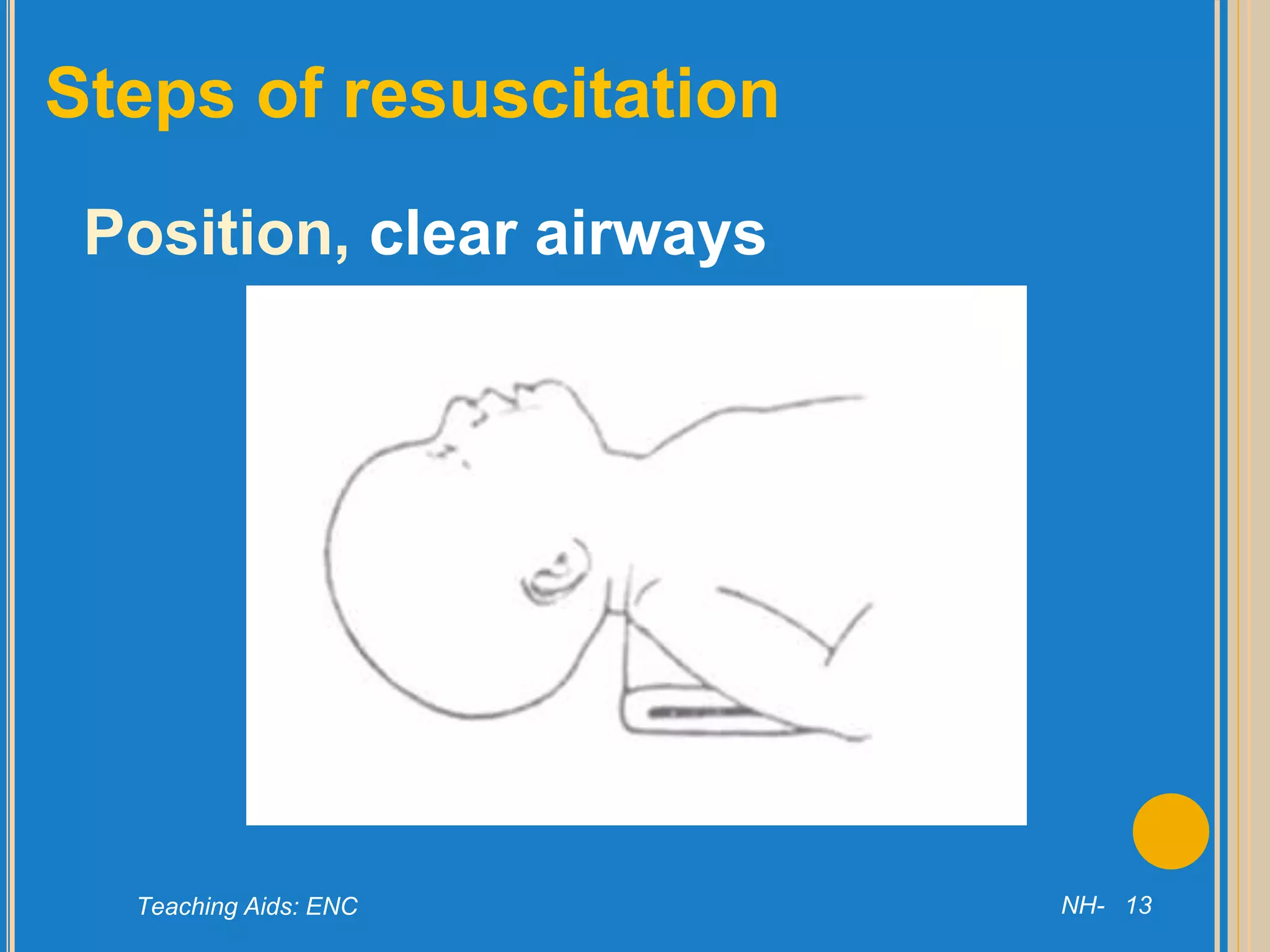 Newborn Resuscitation.ppt