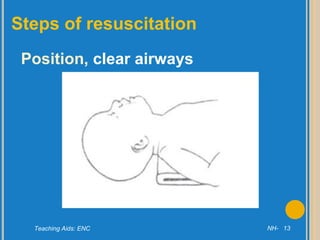 Newborn Resuscitation.ppt