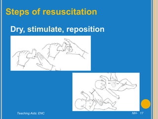 Newborn Resuscitation.ppt