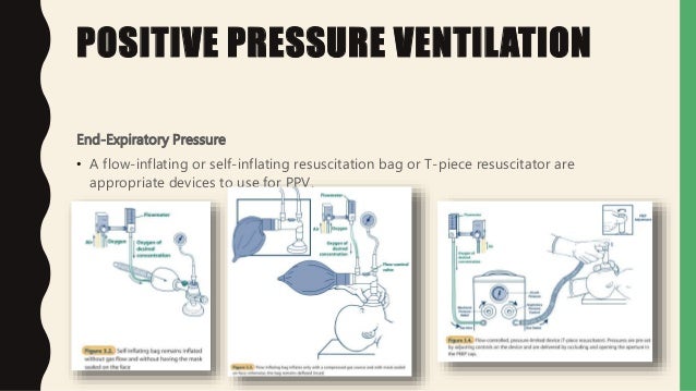 Newborn resuscitation program