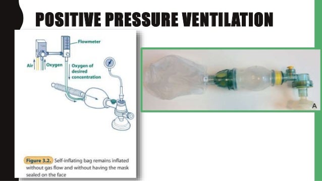 Newborn resuscitation program
