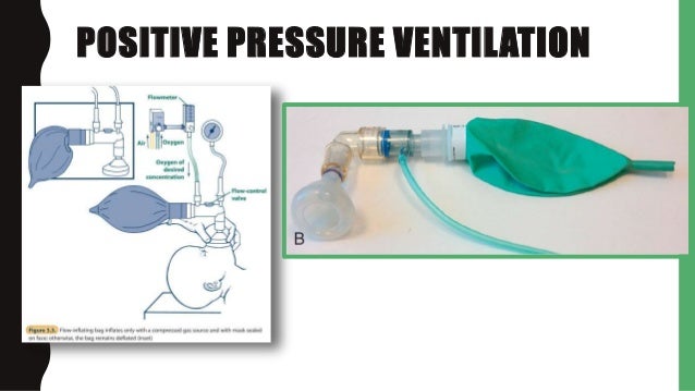 Newborn resuscitation program