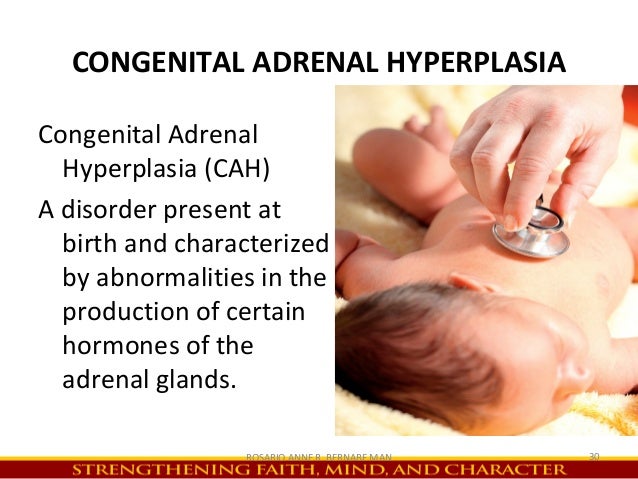 Congenital Adrenal Hyperplasia And Testicular Feminization Syndromes Dr