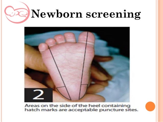 Newborn screening kuwait