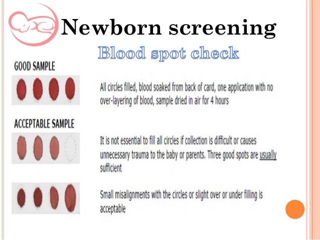 Newborn screening kuwait
