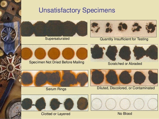 Newborn screening 2014