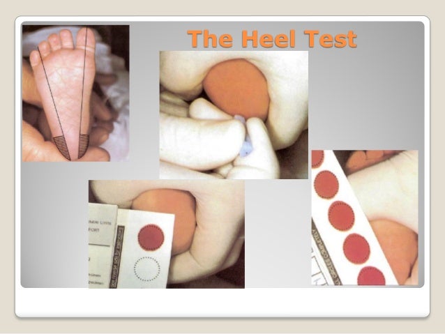 Newborn screening kuwait