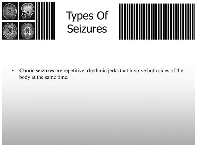 Types Of Seizures Myeshi Briley,HS-BCP | PPT