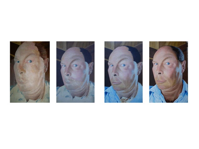 Self-imaging and trauma | PPT