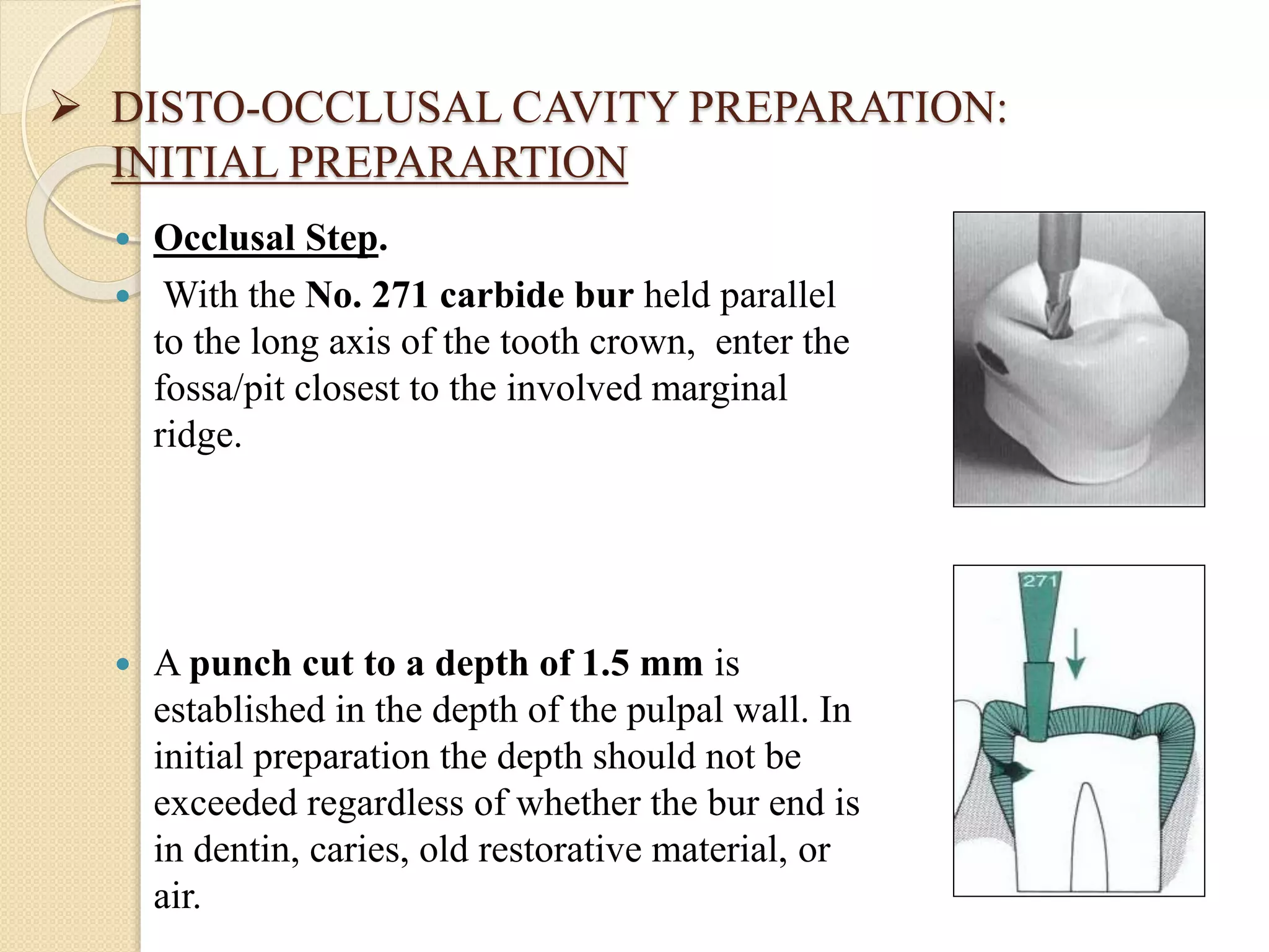 new cast metal inlay.pptx