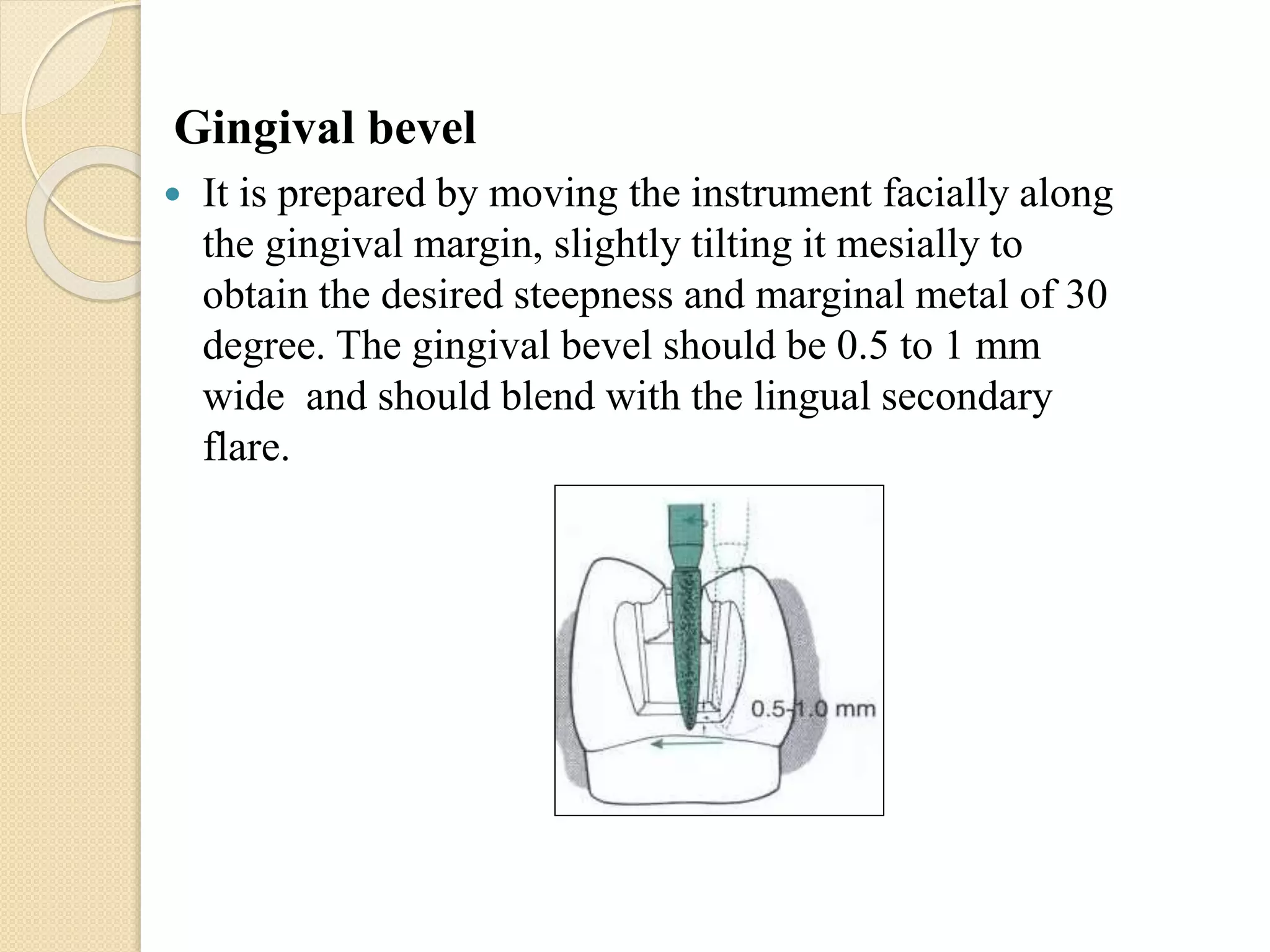 new cast metal inlay.pptx