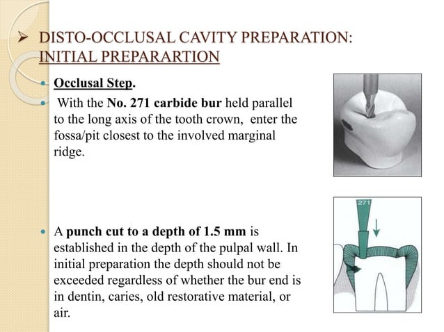new cast metal inlay.pptx | Dental Health | Diseases and Conditions