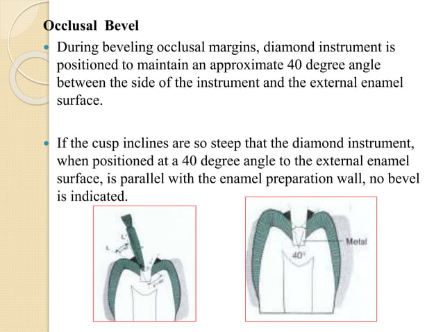 new cast metal inlay.pptx | Dental Health | Diseases and Conditions