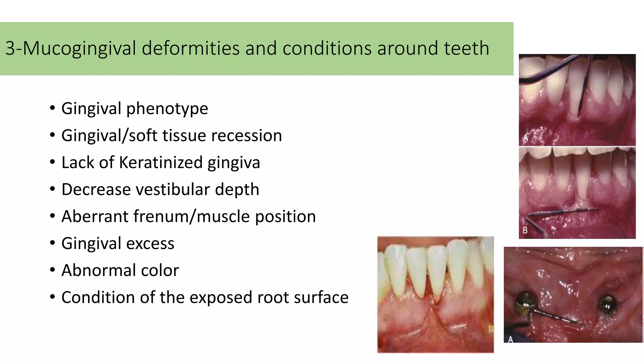 New classification of the periodontal diseases | PPTX