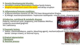 New classification of the periodontal diseases | PPTX