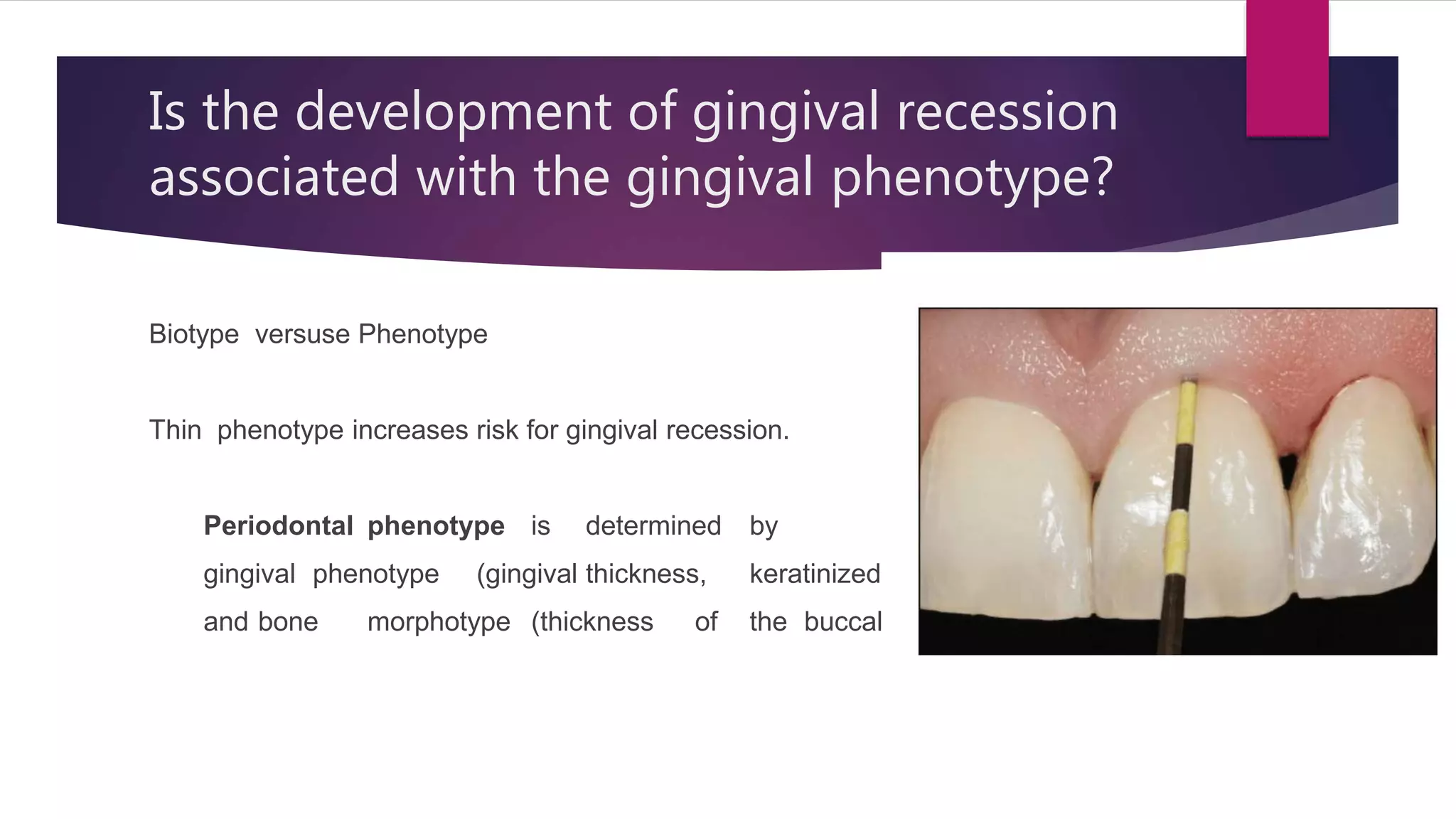 New classification of periodontal disease | PPTX