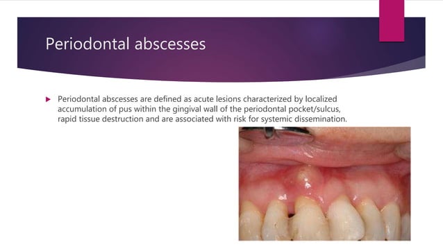 New classification of periodontal disease | PPTX | Dental Health ...