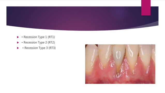 New classification of periodontal disease | PPTX | Dental Health ...