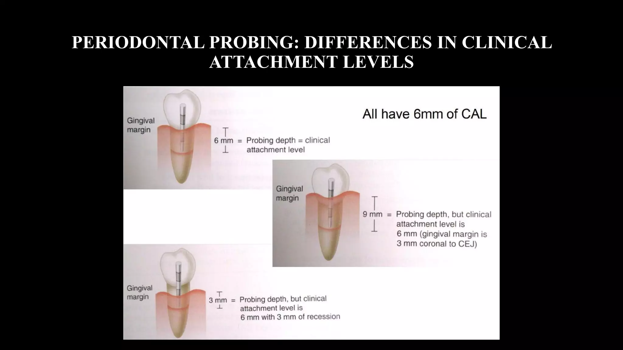 New Classification of Periodontitis(5).pdf