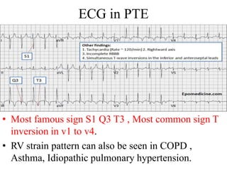 clinical aspects of pulmonary embolism | PPTX