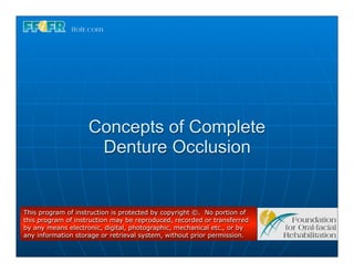 (New) concepts of complete denture occlusion | PDF