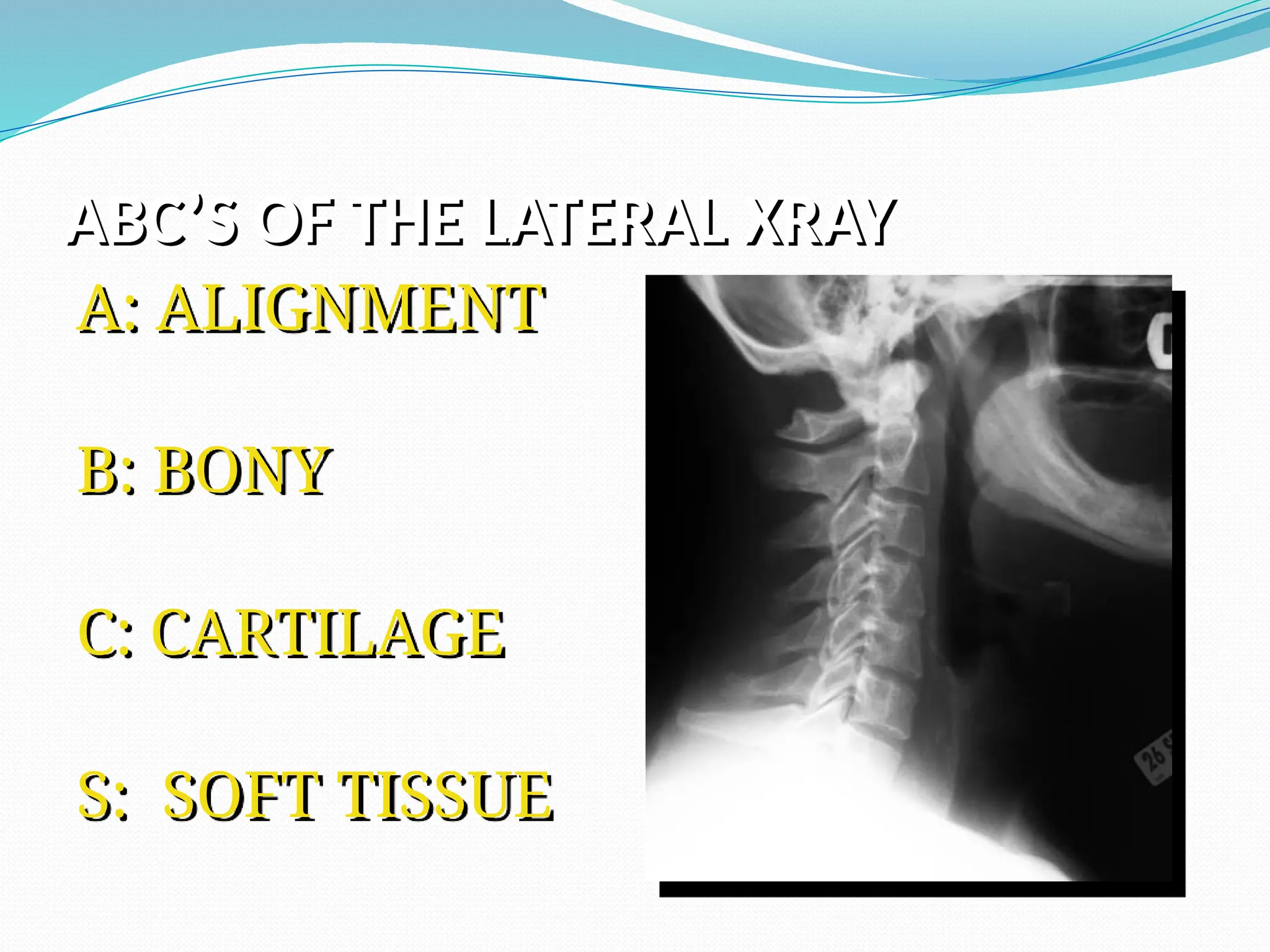 c spine injuries classification management | PPTX
