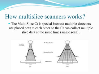 Difference Between Single Slice and Multi Slice CT Scanner | PPTX