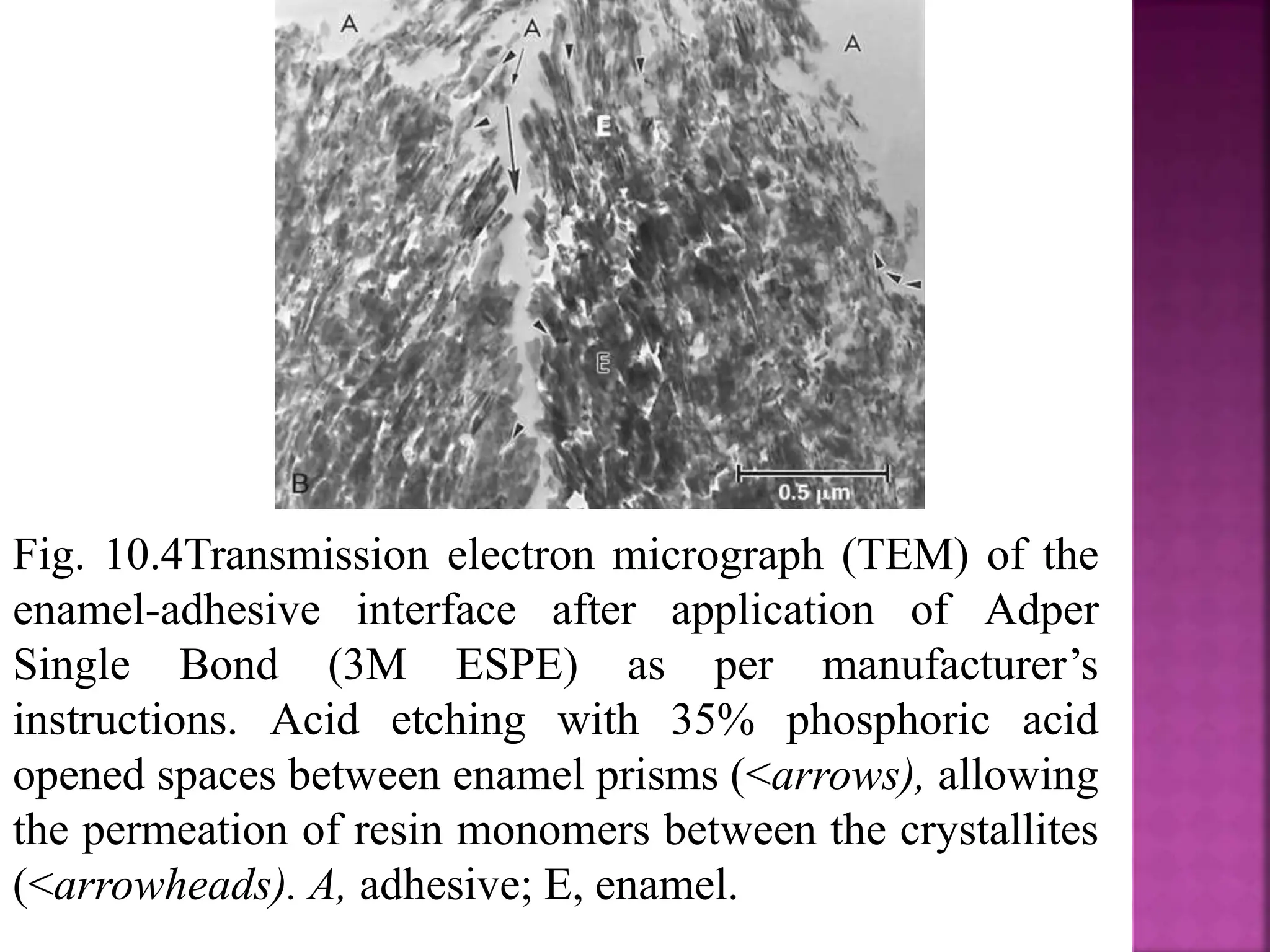 new dba-1(1).pptx DENTIN BONDING AGENTS GENERATIONS, ADVANTAGES N DISADVANTAGES | PPT | Free ...
