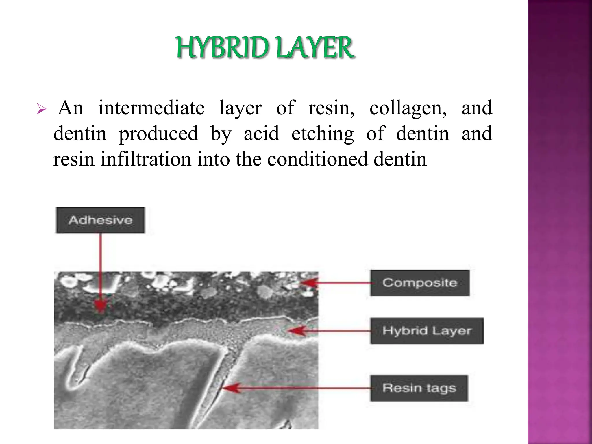 new dba-1(1).pptx DENTIN BONDING AGENTS GENERATIONS, ADVANTAGES N DISADVANTAGES | PPT | Free ...