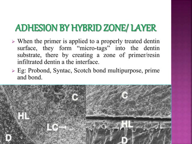 new dba-1(1).pptx DENTIN BONDING AGENTS GENERATIONS, ADVANTAGES N DISADVANTAGES | PPT | Free ...