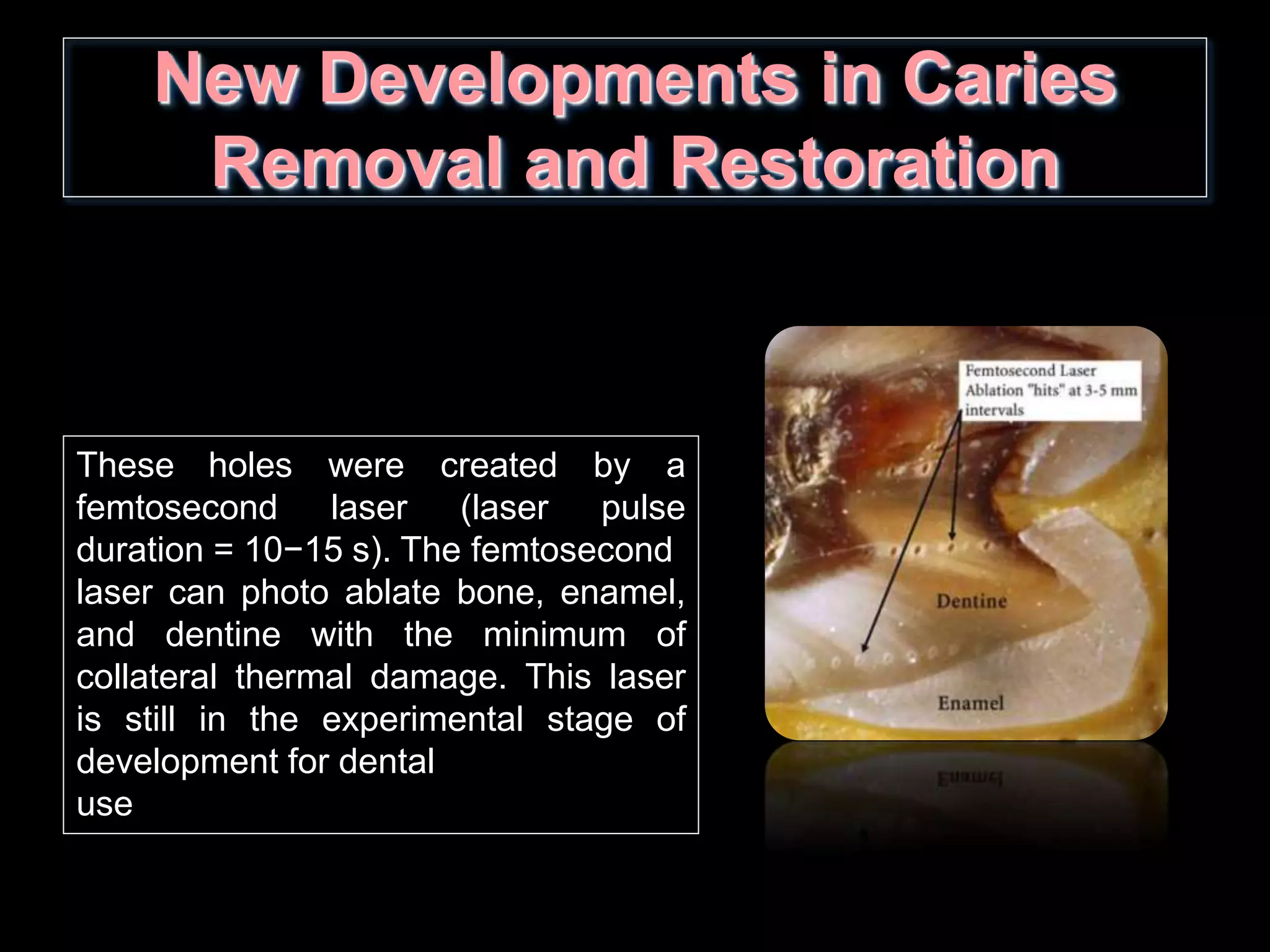 New development in careis removal and restoration | PPT