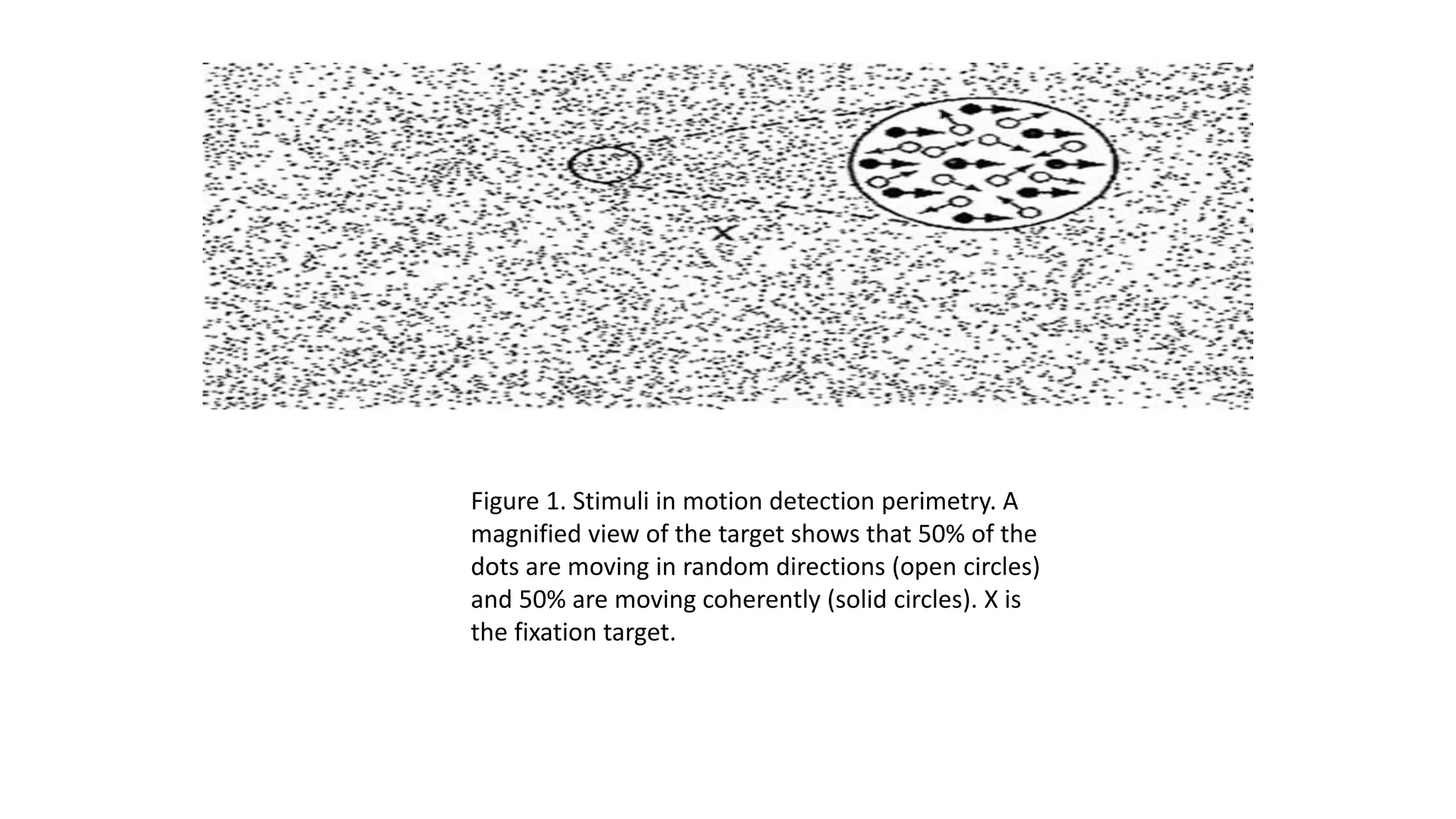 New developments in perimetry | PPTX