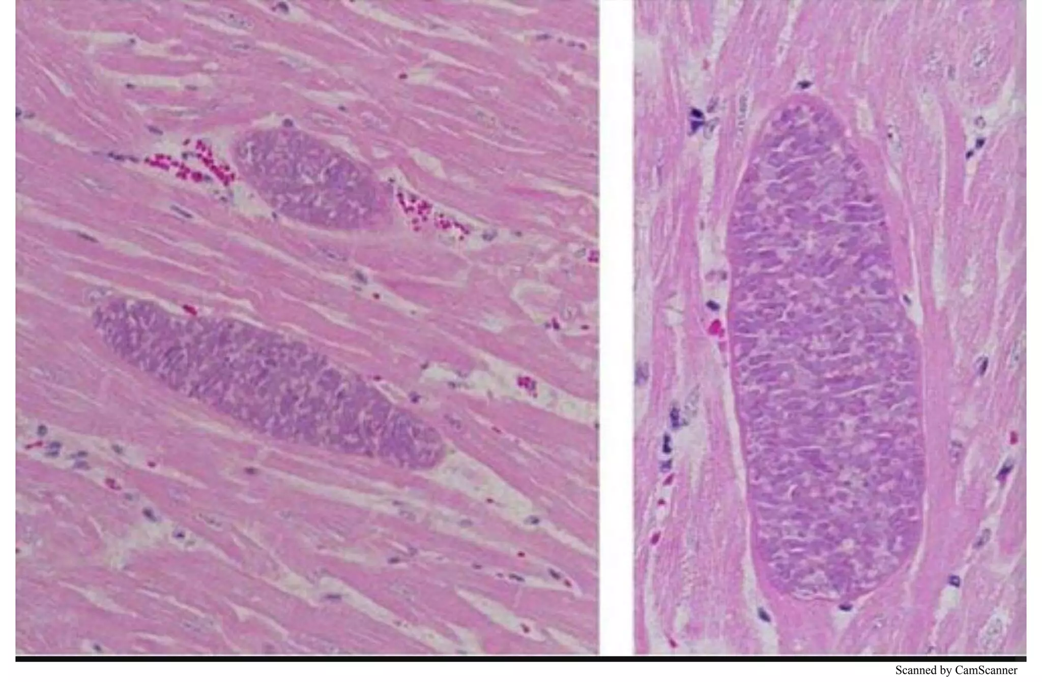 cysticercus tenuicollis&sarcocyst collection photos in sheep | PDF