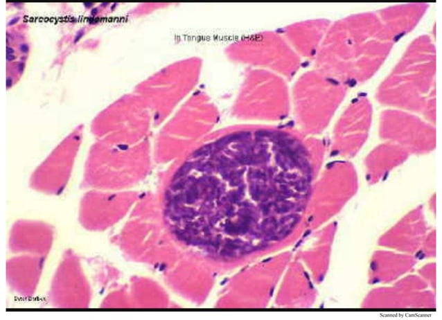 cysticercus tenuicollis&sarcocyst collection photos in sheep