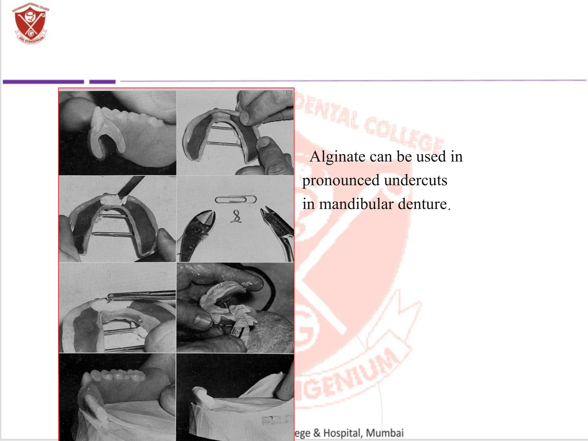 RELINING REBASING AND REPAIR OF COMPLETE DENTURE.ppt