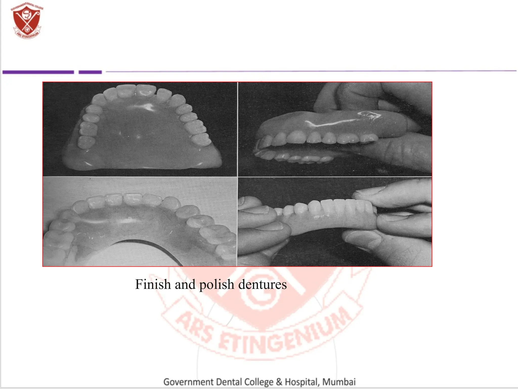 RELINING REBASING AND REPAIR OF COMPLETE DENTURE.ppt