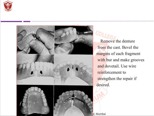 RELINING REBASING AND REPAIR OF COMPLETE DENTURE.ppt