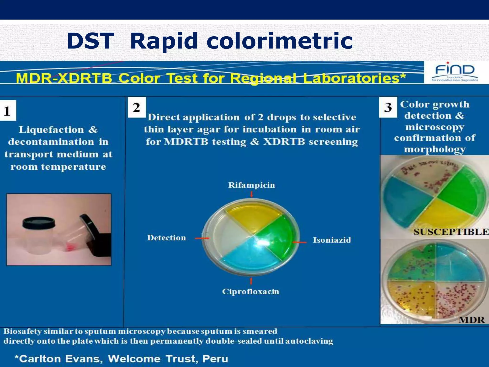 Newer diagnostic methods for tuberculosis | PPTX
