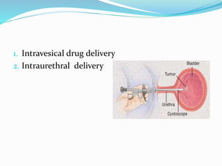 Newer drug delivery methods | PPTX