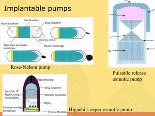 Newer drug delivery systems | PPTX