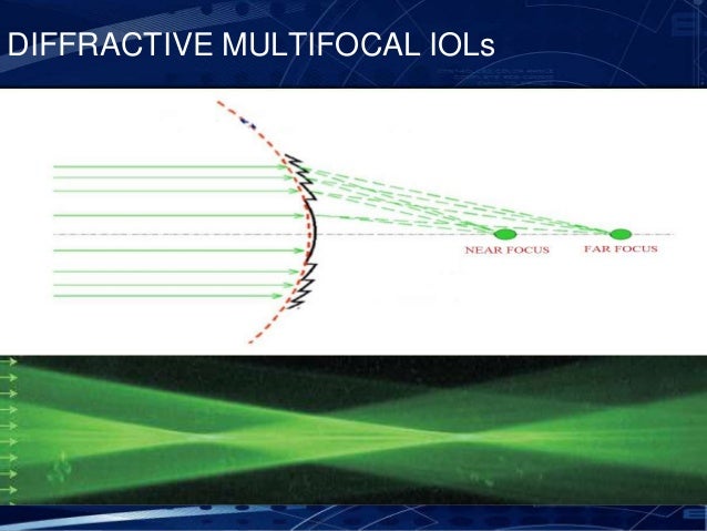Newer IOLs