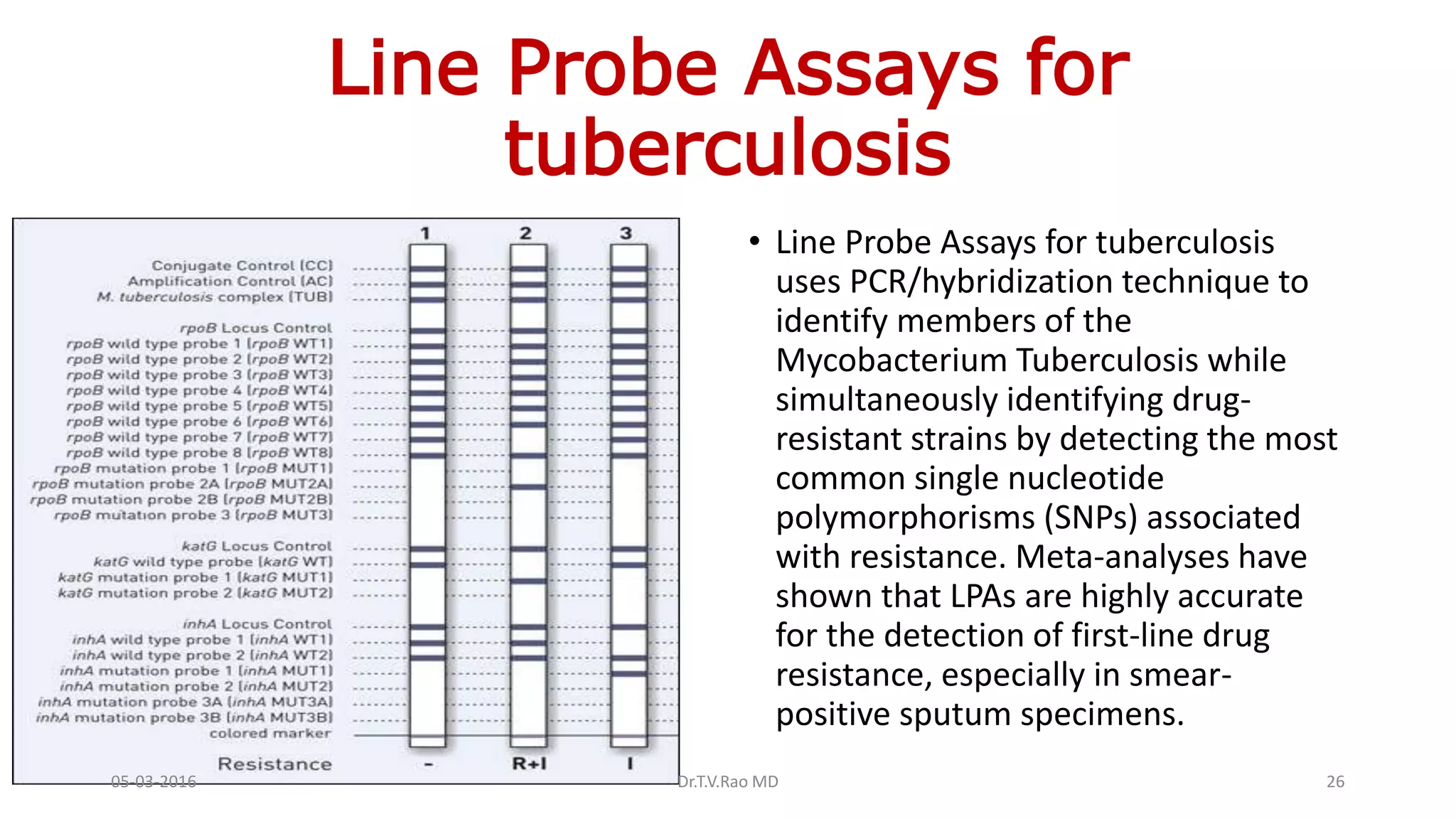 NEW TECHNOLOGIES IN DIAGNOSIS OF TUBERCULOSIS | PPTX