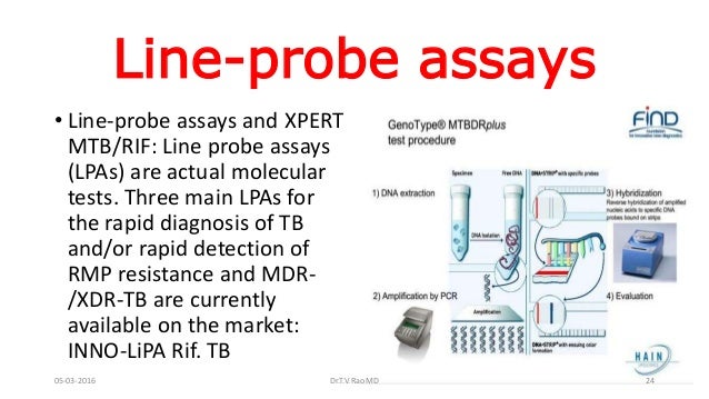 NEW TECHNOLOGIES IN DIAGNOSIS OF TUBERCULOSIS