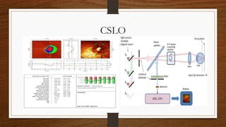 Newer modalities in diagnosis of glaucoma | PPT