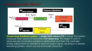 Newer modes of ventilation used in icu -1 pptx. | PPTX