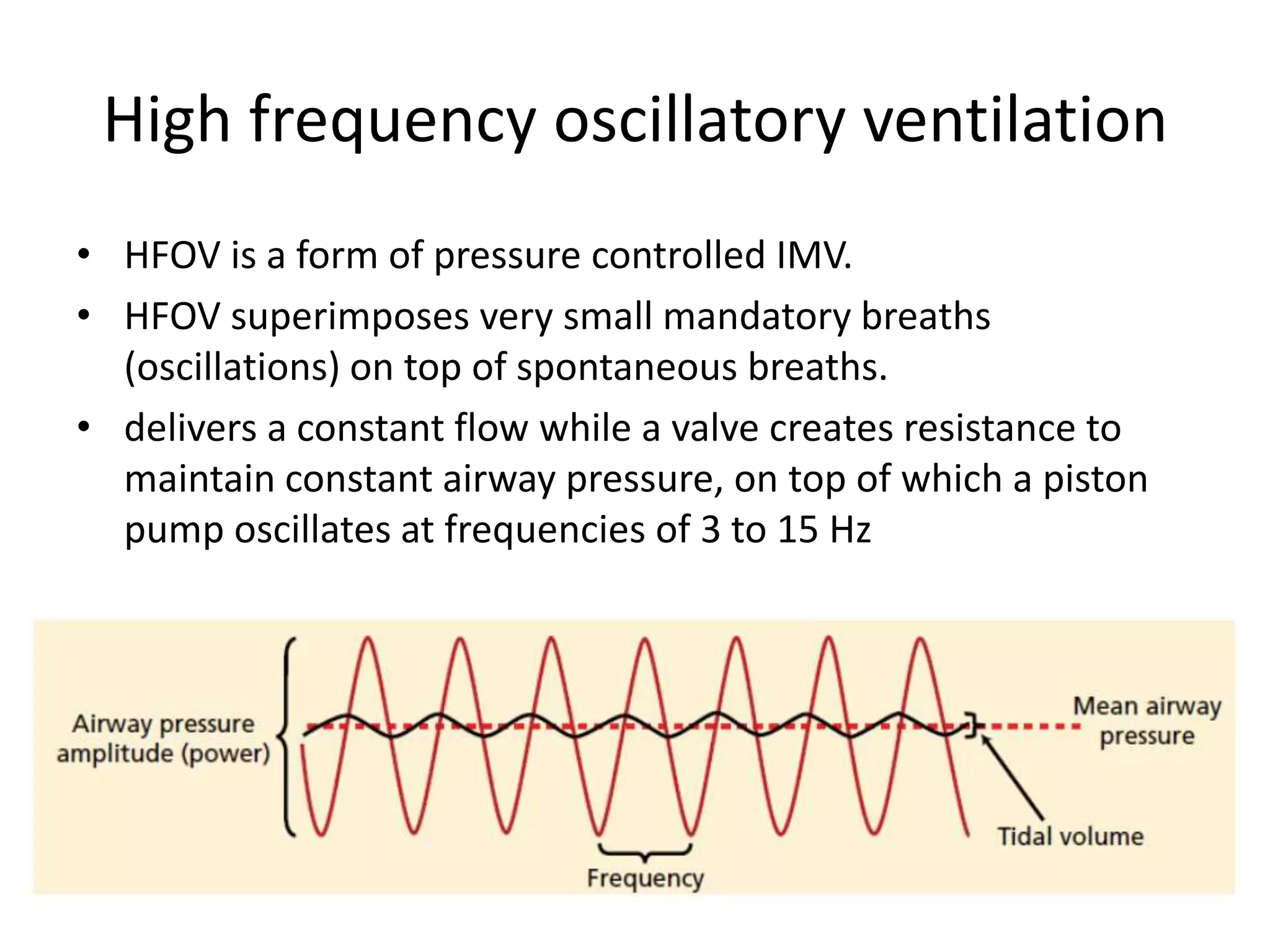 Newer modes of ventilation | PPTX