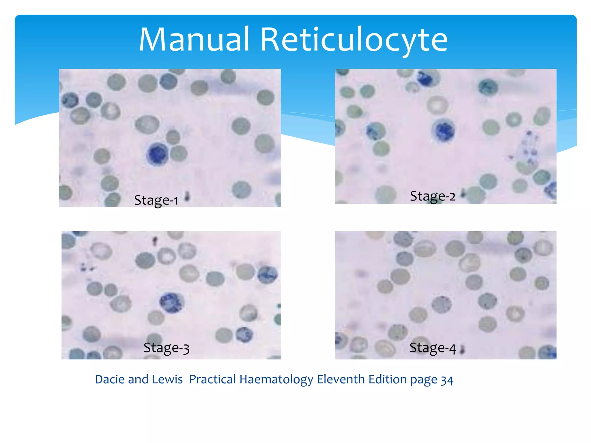 Newer reticulocyte parametes | PDF